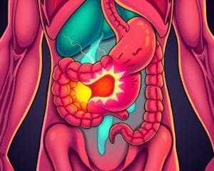 what happens if your appendix bursts